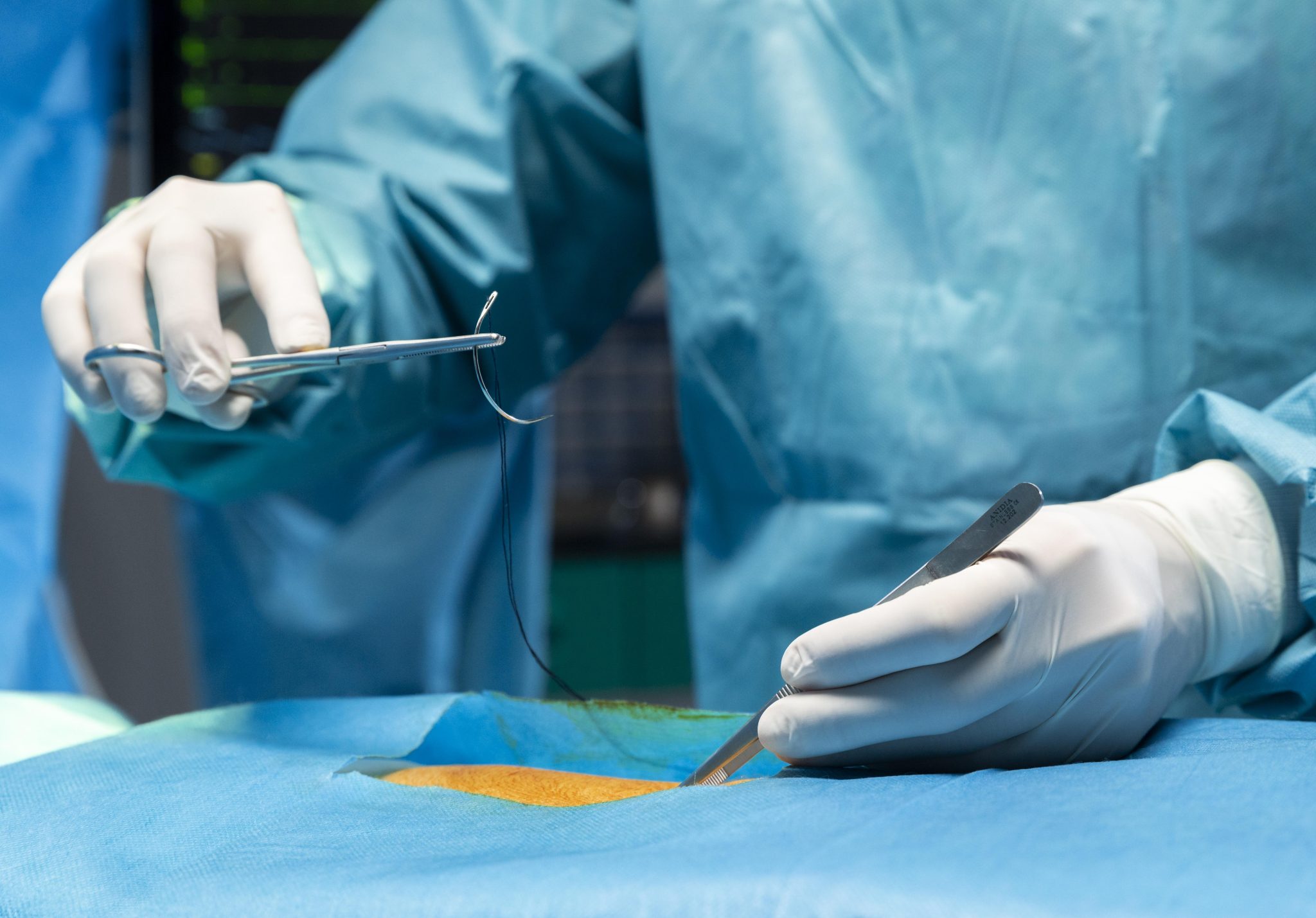 Laparoscopic & General Surgery in Punjab | Raja Hospital